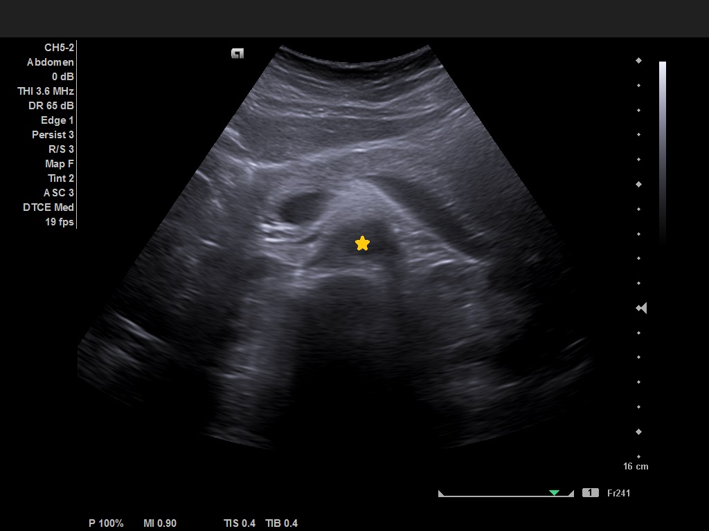 Flashcards – GastroCloud