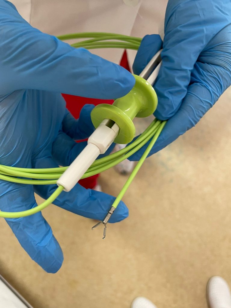 Hemostasis by clips – GastroCloud