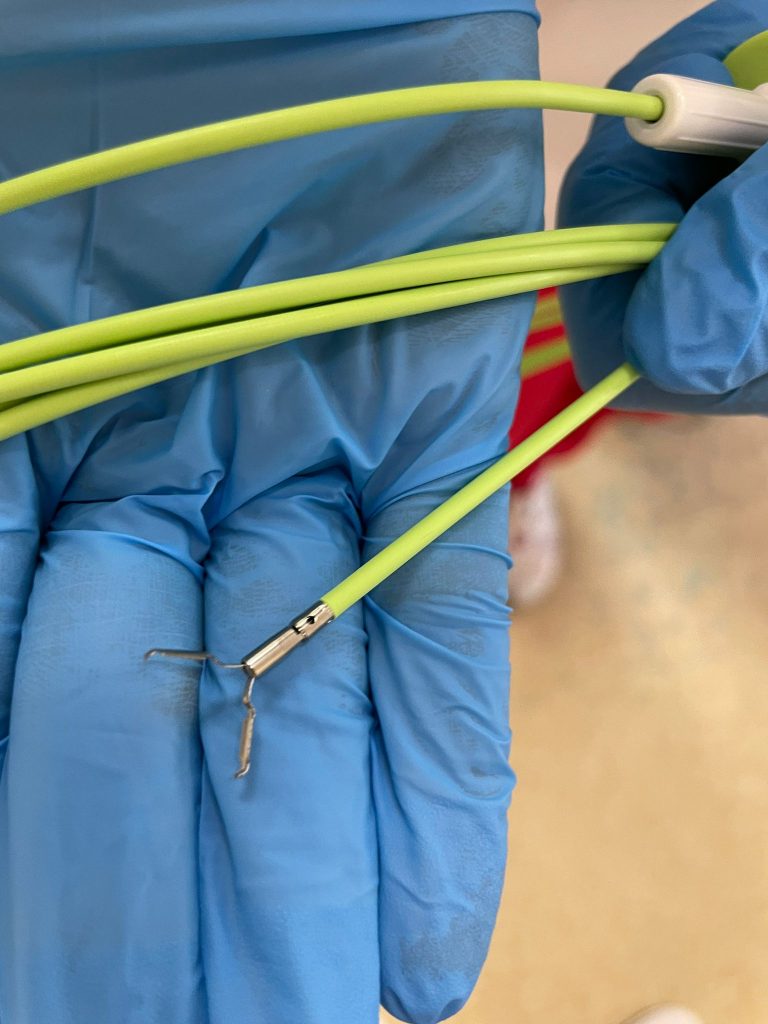 Hemostasis by clips – GastroCloud