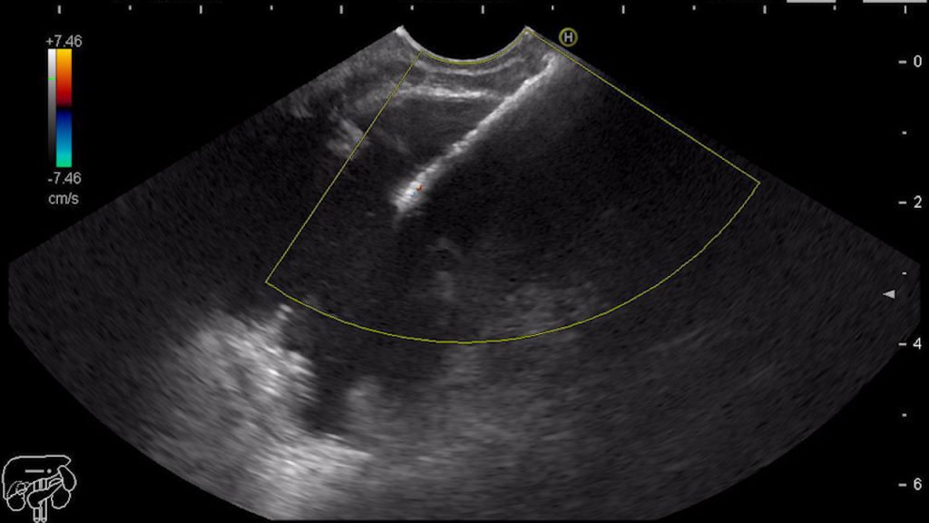 WOPN drainage – GastroCloud