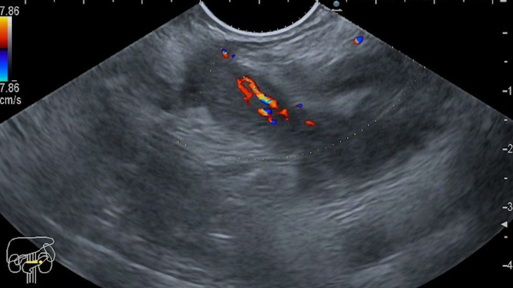 Clinical cases – GastroCloud