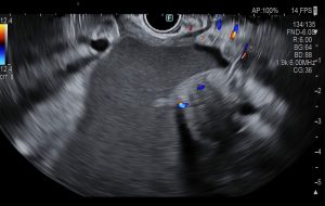 Case of the month – GastroCloud