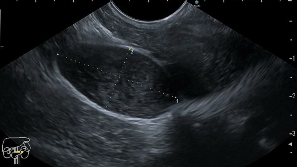 Clinical cases – GastroCloud