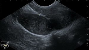 Clinical cases – GastroCloud