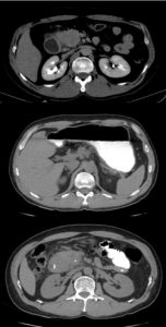 Clinical cases – GastroCloud